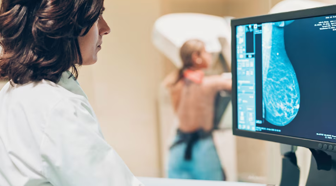 Cáncer De Mama Cuáles Son Los Síntomas Y Tratamientos De La Enfermedad